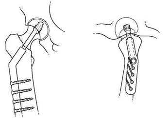 Theatre Radiography - Clark's Positioning In Radiography - by A. S. Whitley