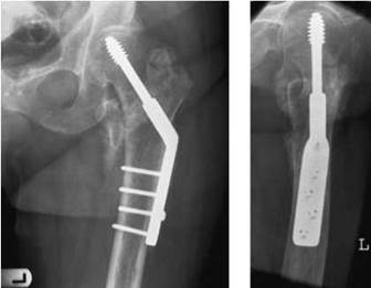 Theatre Radiography - Clark's Positioning In Radiography - by A. S. Whitley