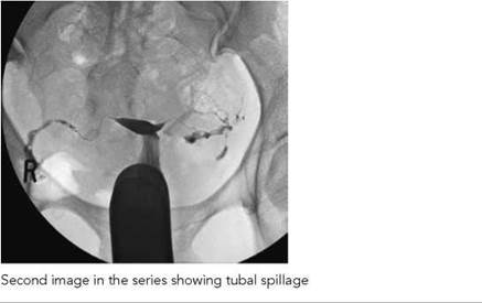 Theatre Radiography - Clark's Positioning In Radiography - by A. S. Whitley