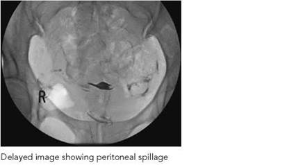 Theatre Radiography - Clark's Positioning In Radiography - by A. S. Whitley