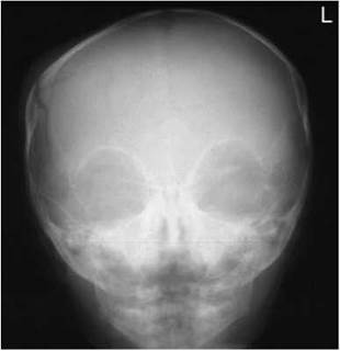 Paediatric Radiography - Clark's Positioning In Radiography - by A. S ...