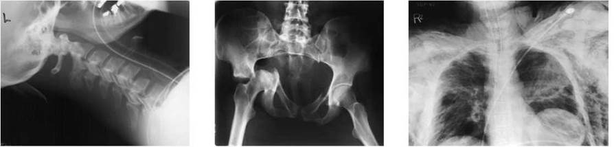 Miscellaneous - Clark's Positioning In Radiography - by A. S. Whitley