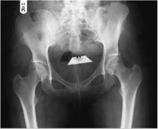 Miscellaneous - Clark's Positioning In Radiography - by A. S. Whitley