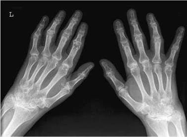 Miscellaneous - Clark's Positioning In Radiography - by A. S. Whitley