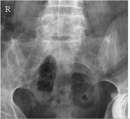 Miscellaneous - Clark's Positioning In Radiography - by A. S. Whitley