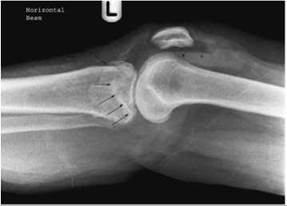 Miscellaneous - Clark's Positioning In Radiography - by A. S. Whitley