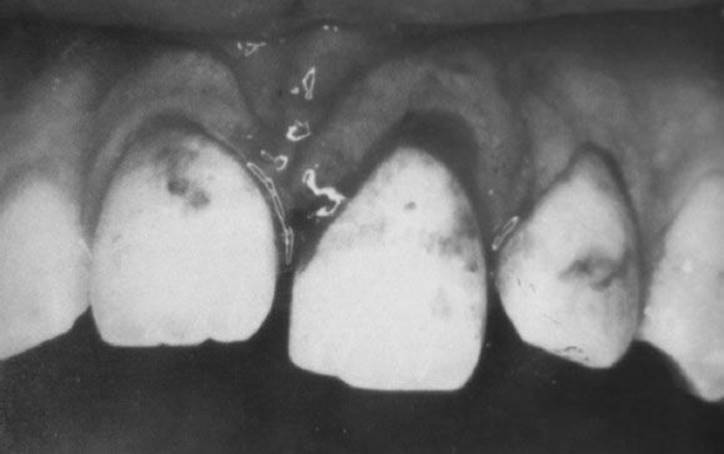 Dental Injuries - Trauma - Harwood-Nuss' Clinical Practice of Emergency ...
