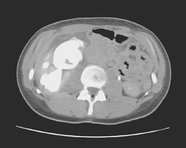 Genitourinary Trauma - Trauma - Harwood-Nuss' Clinical Practice of ...