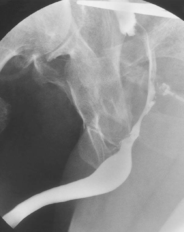Genitourinary Trauma - Trauma - Harwood-Nuss' Clinical Practice of ...