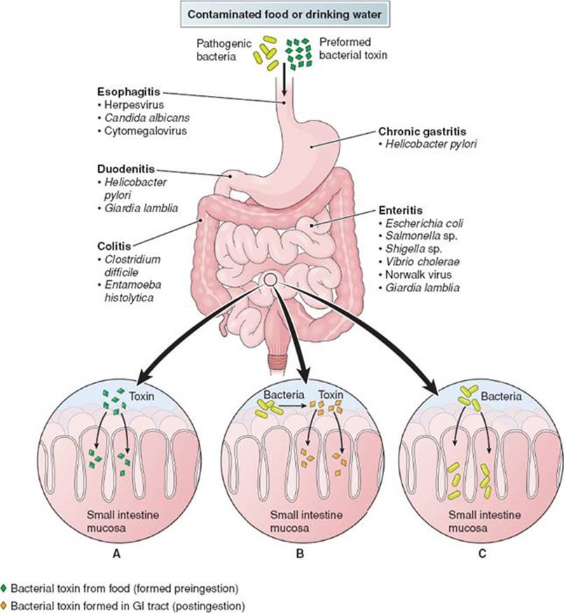 Diarrhea - Gastrointestinal Emergencies - Harwood-Nuss' Clinical ...