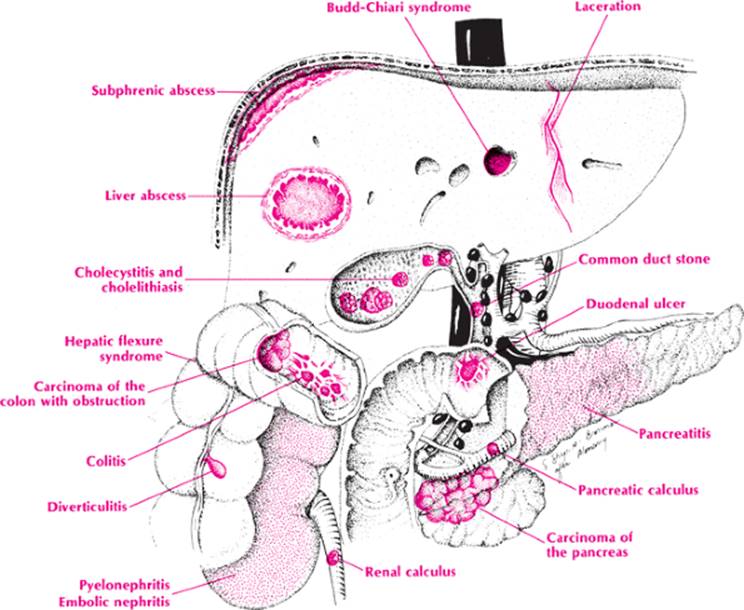 Abdominal Pain - Differential Diagnosis in Primary Care, 4th Edition
