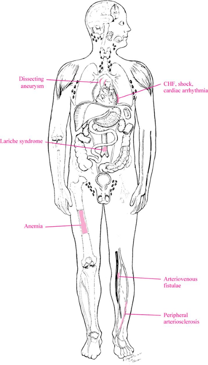 Absent or Diminished Pulse - Differential Diagnosis in Primary Care ...