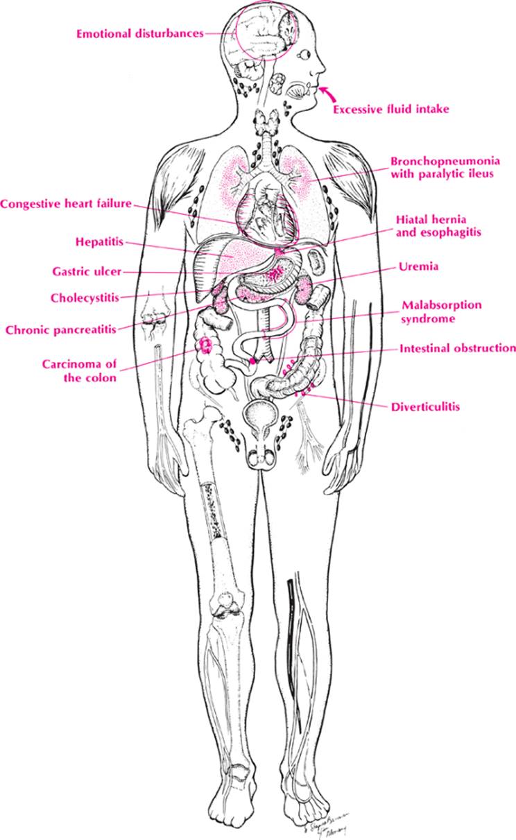 Flatulence and Borborygmi - Differential Diagnosis in Primary Care, 4th ...