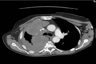 Common respiratory investigations - Essential respiratory medicine