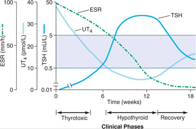 Thyroid Gland Disorders - Endocrinology and Metabolism - Harrisons ...