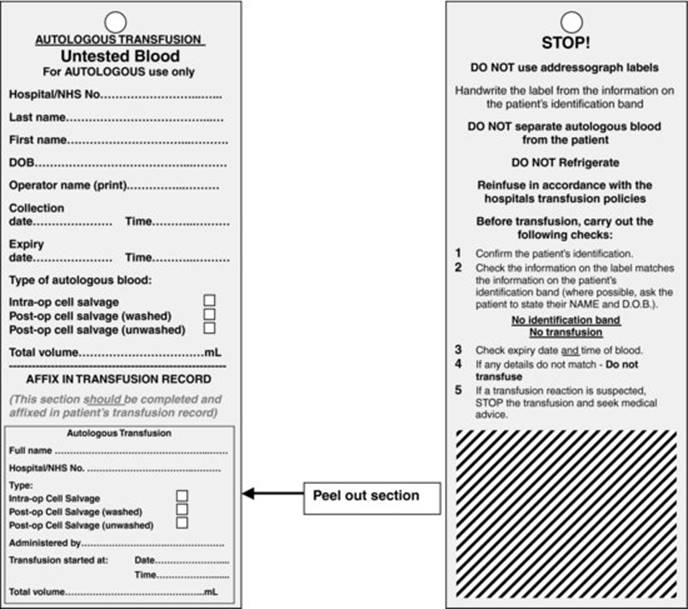Autologous transfusion - Alternatives to Transfusion - Practical ...