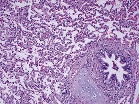 Development of Lung - Thoracic Pathology: A Volume in the High Yield ...