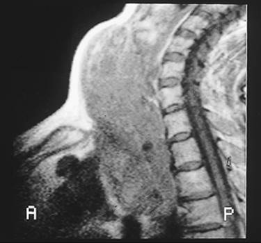 Nonisotopic Techniques of Thyroid Imaging - Werner & Ingbar's The ...
