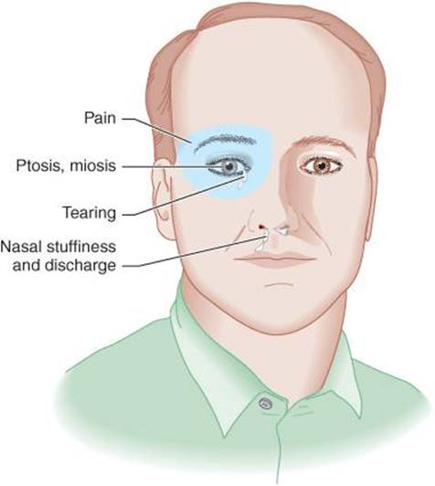 Headache and Facial Pain - Clinical Neurology, 8th Ed.