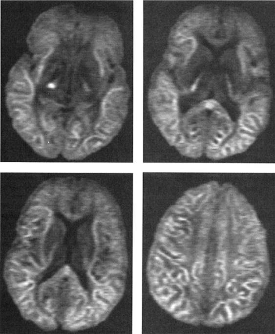 Forensic Neurologic Injury - Catastrophic Neurologic Disorders in the ...
