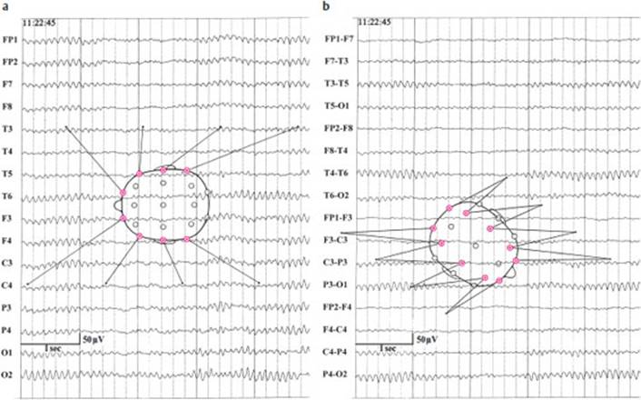 Ancillary Tests in Neurology - Fundamentals of Neurology: An ...
