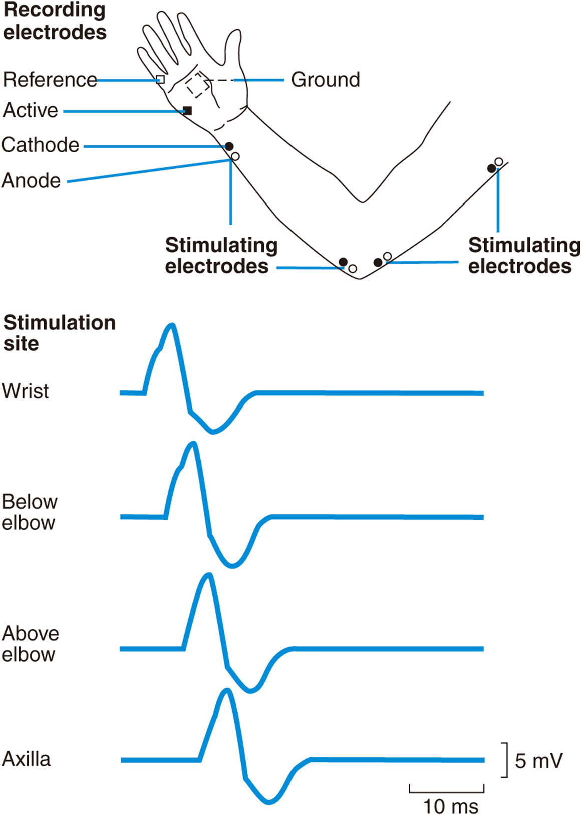 ELECTRODIAGNOSTIC STUDIES OF NERVOUS SYSTEM DISORDERS: EEG, EVOKED ...