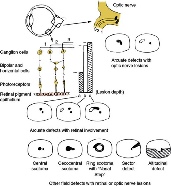 Visual Pathways - Localization in Clinical Neurology, 6 Ed.