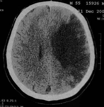 Introduction to Neurology - Neuroanatomy for Speech-Language Pathology ...