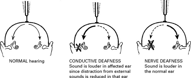 GENERAL APPROACH TO HISTORY AND EXAMINATION - Neurology and ...