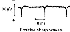 INVESTIGATIONS OF THE CENTRAL AND PERIPHERAL NERVOUS SYSTEMS ...