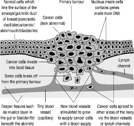 Tumours - Cancer Care (Nursing and Health Survival Guides), 1e