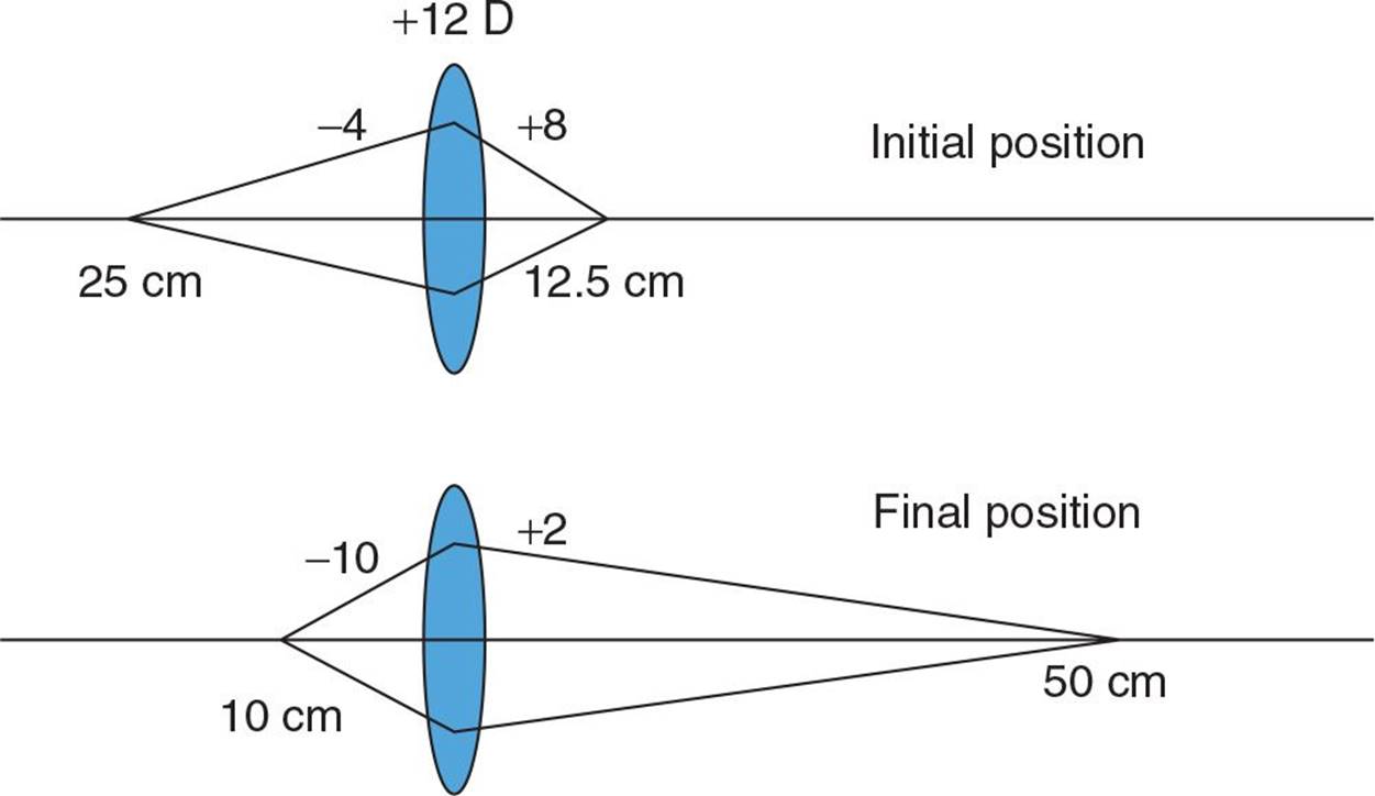 Optics - Review questions in ophthalmology