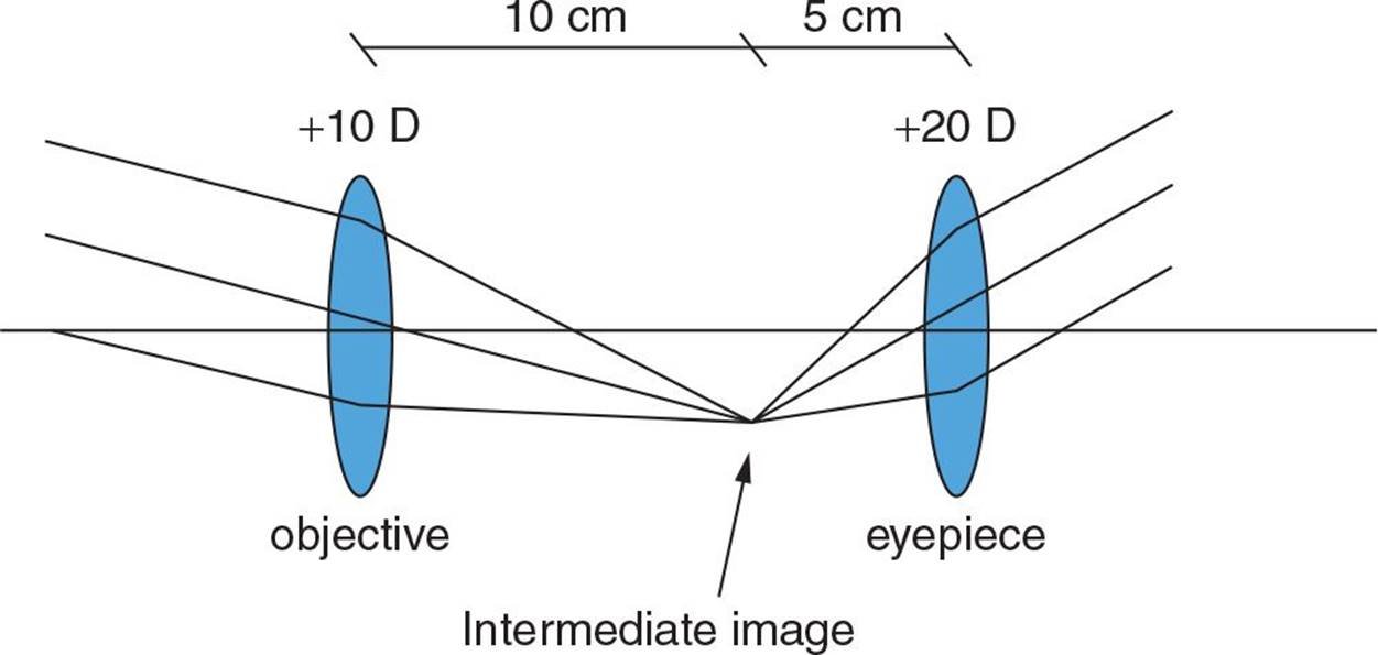 Optics - Review questions in ophthalmology