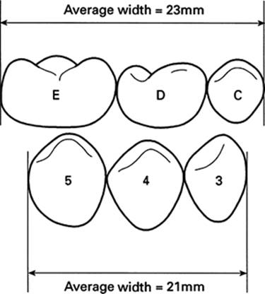 Management of the developing dentition - An Introduction to ...