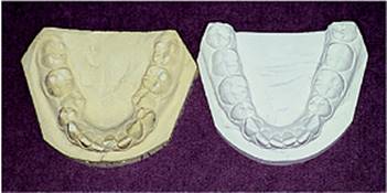 Treatment planning - An Introduction to Orthodontics, 2nd Edition