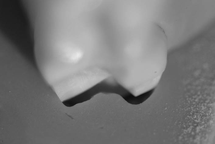 Principles of indirect restoration - Principles of operative dentistry