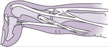 Hand Surgery - Current Diagnosis & Treatment in Orthopedics, 5th Ed.
