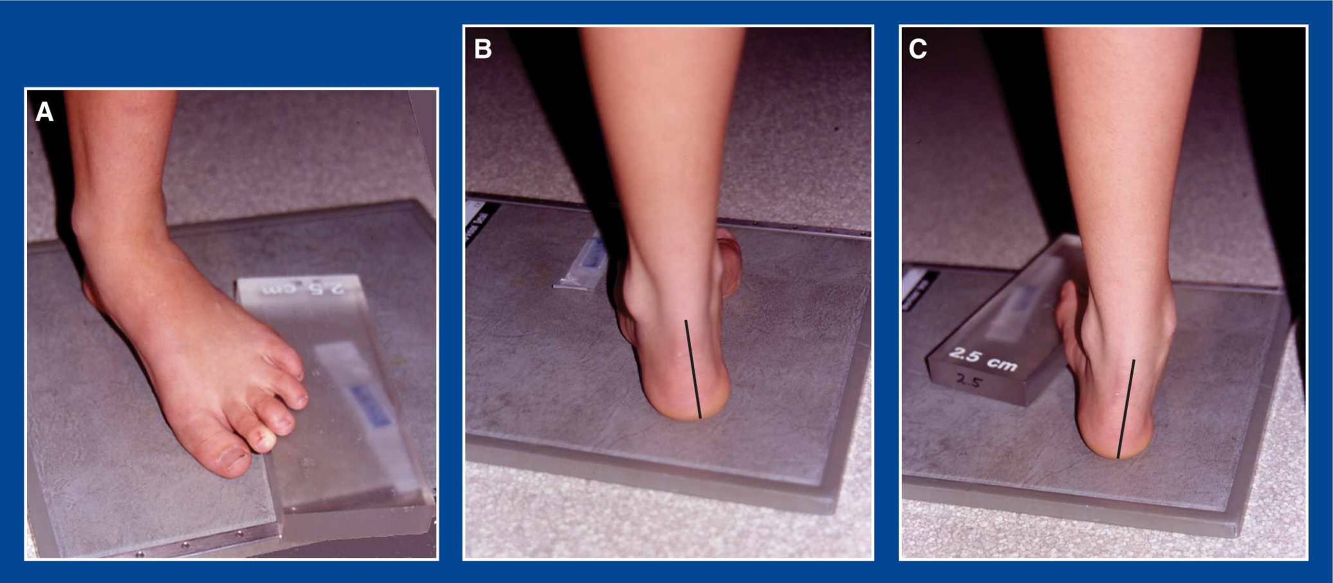 ASSESSMENT PRINCIPLES - Principles and Management of Pediatric Foot and ...