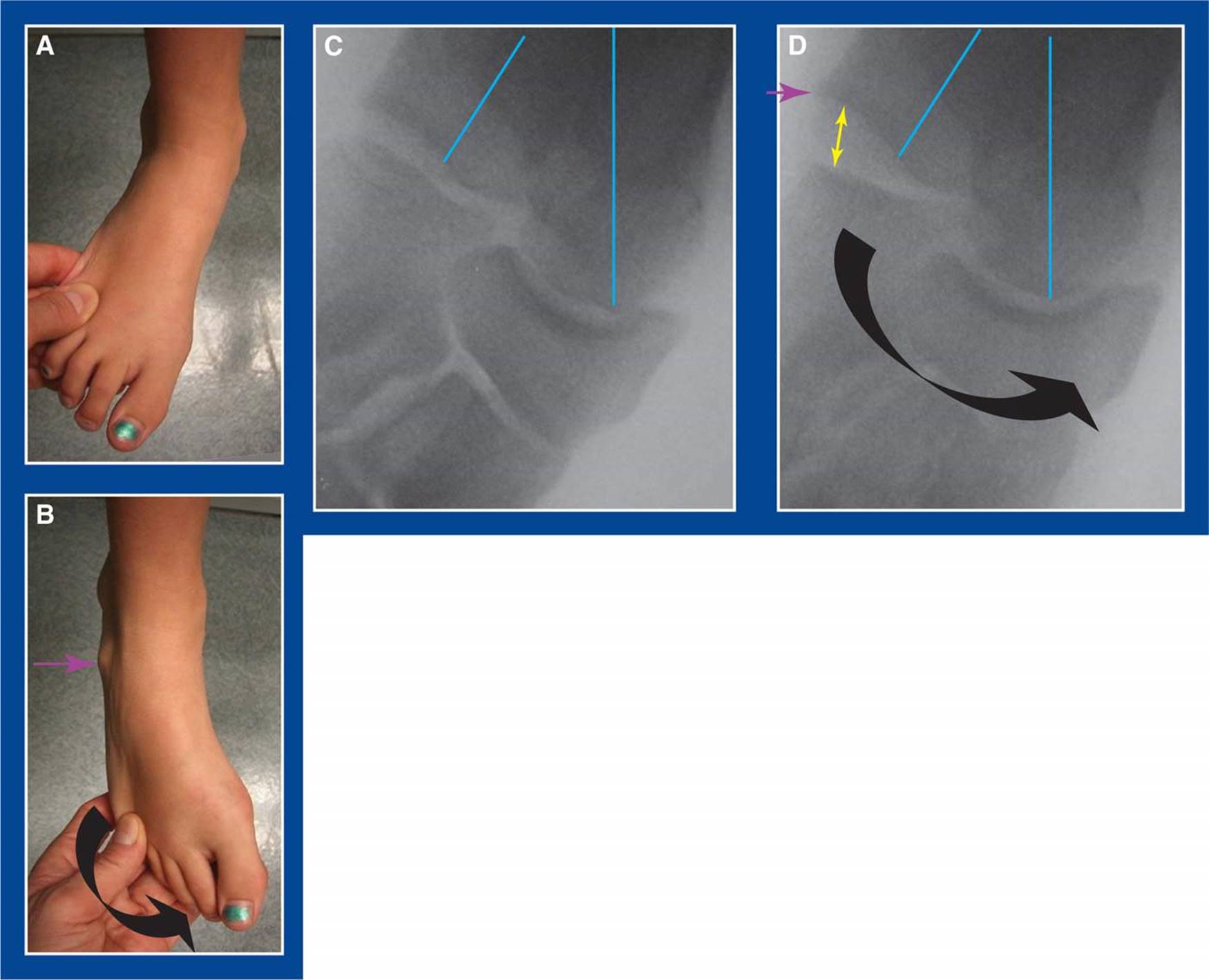ASSESSMENT PRINCIPLES - Principles and Management of Pediatric Foot and ...