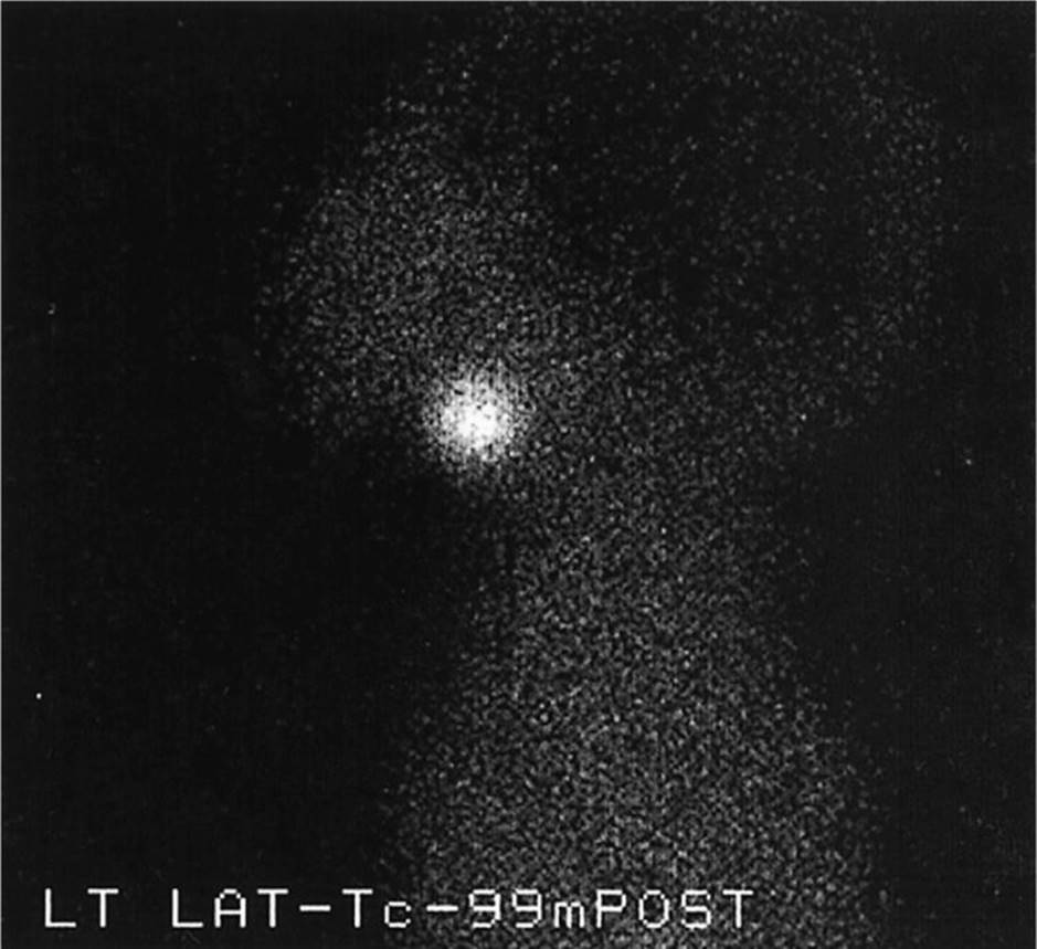 Twelve-Month-Old Girl - CONSTIPATION - Symptom-Based Diagnosis in ...