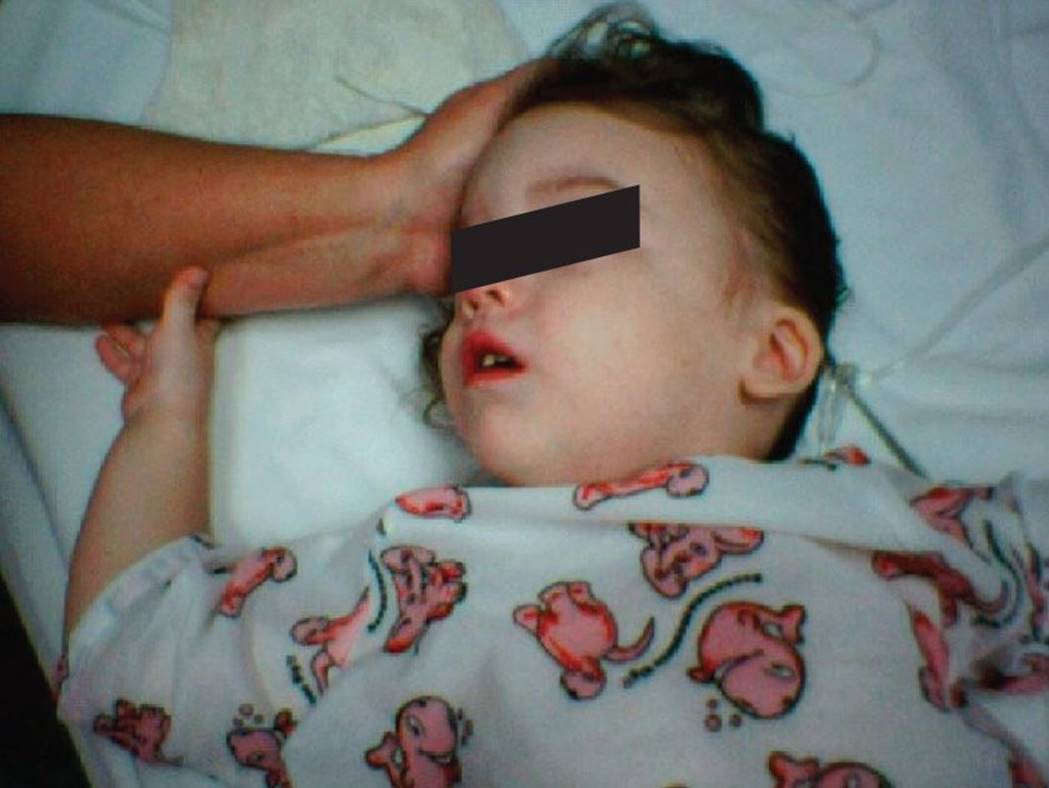 General Appearance - Visual Diagnosis and Treatment in Pediatrics, 3 Ed.