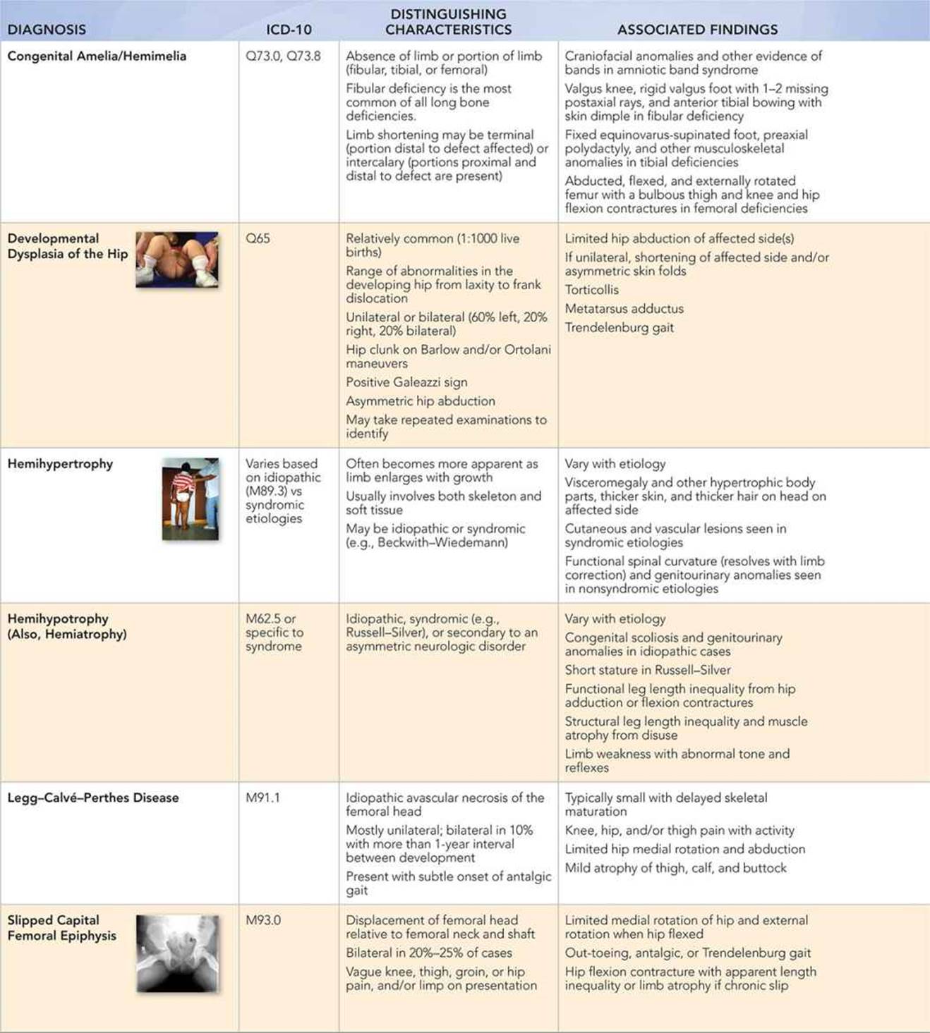 Leg Asymmetry - Visual Diagnosis and Treatment in Pediatrics, 3 Ed.