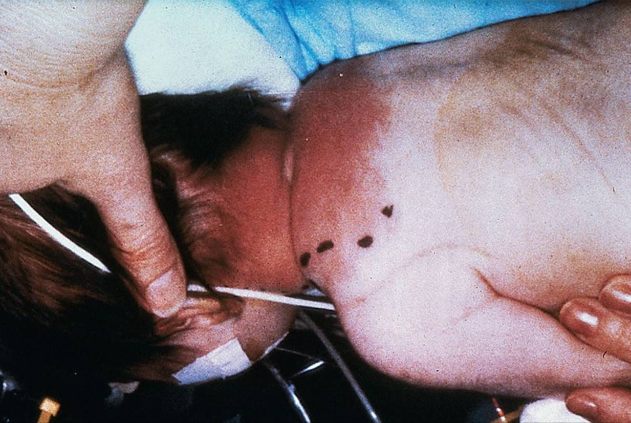 Red Patches and Swellings - Visual Diagnosis and Treatment in ...