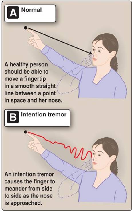 Motor Control Systems - Lippincott Illustrated Reviews: Physiology ...