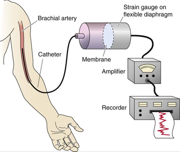 How to Measure Blood Pressure, Blood Flow, and Cardiac Volumes ...