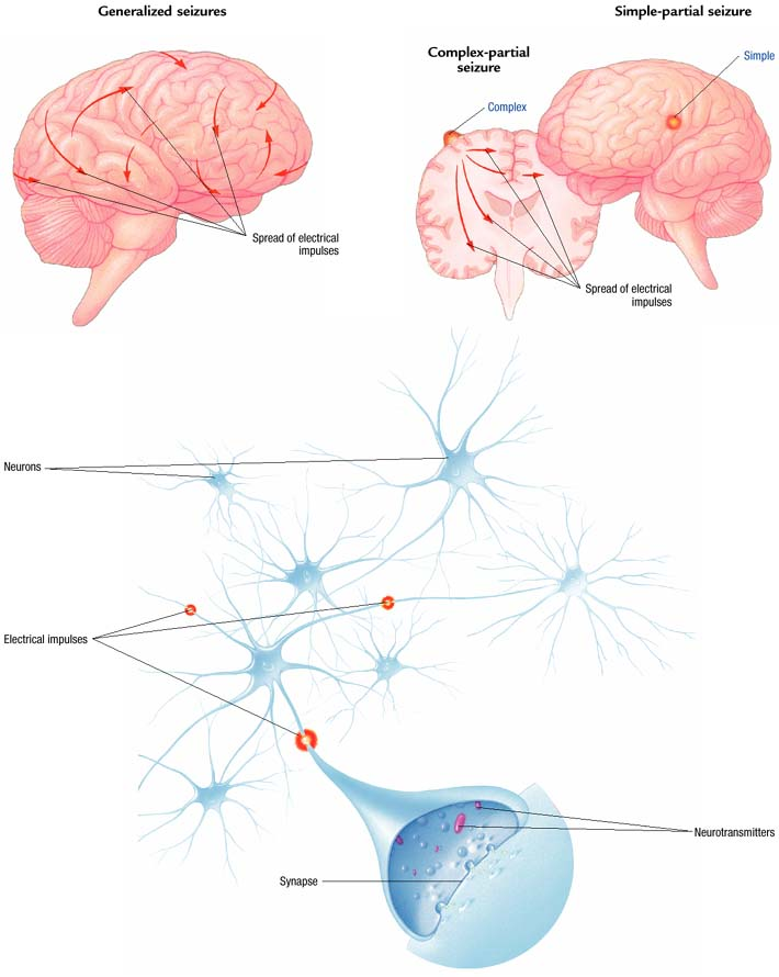 Epilepsy - Atlas of pathophysiology, 2 Edition