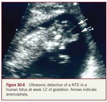 Epidemiology and Prenatal Diagnosis of Congenital Malformations in ...