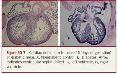 Epidemiology and Prenatal Diagnosis of Congenital Malformations in ...