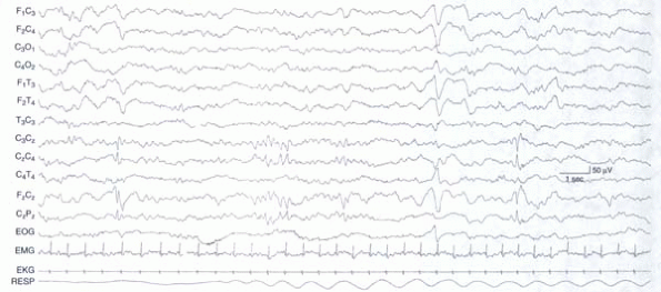 Patterns of Uncertain Diagnostic Significance - Atlas of Neonatal ...