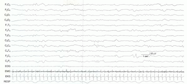 Electroencephalographic Abnormalities of Premature and Term Neonates ...